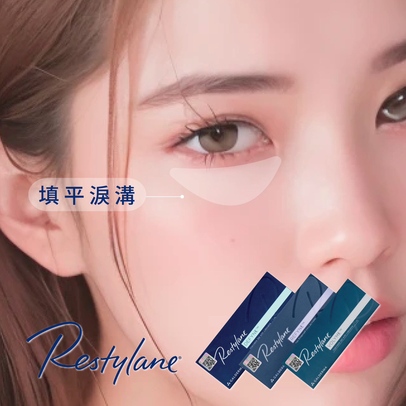 Restylane | 透明質酸針 - inmine